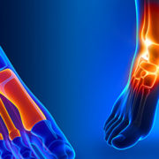 Anatomia do pé - Dr. Rafael Barban